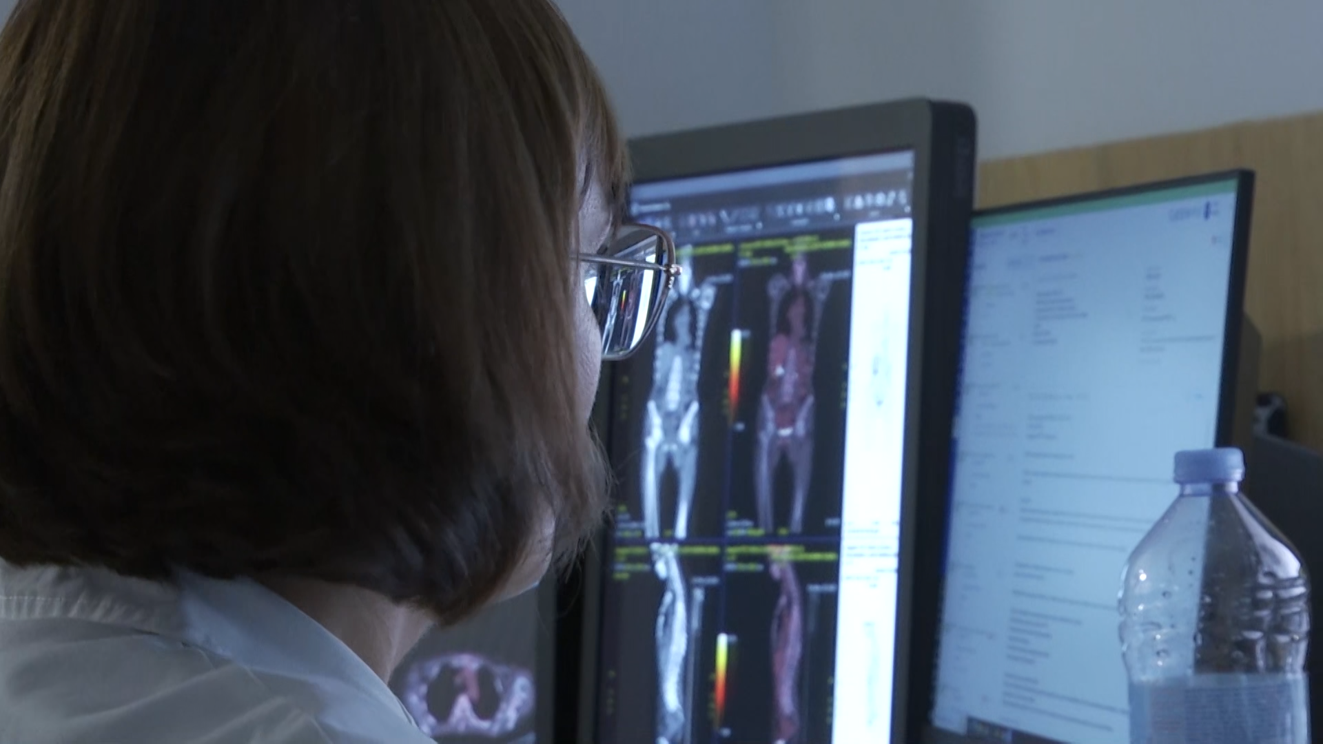 Una eina d’IA de l’IDIBELL i l’ICO dona fiabilitat al trasplant de ...